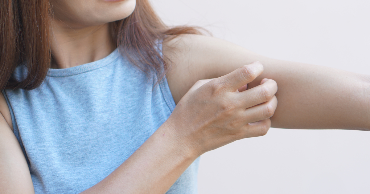 Come riconoscere e curare la sudamina o miliaria nei bambini e negli adulti